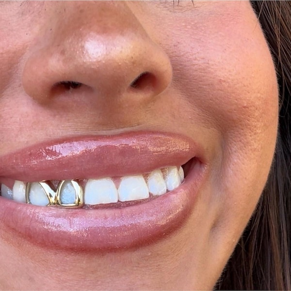 Classic Heart Window Tooth Cap! Custom Grillz, FREE Shipping! - Etsy