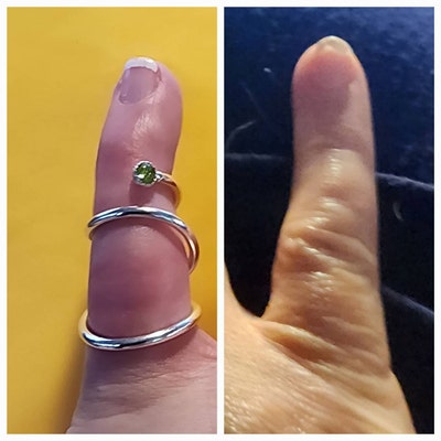 Butterfly Mallet Finger Ring Trigger Finger Splint Ring Sterling Silver ...