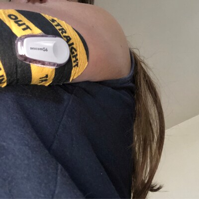Arm Band Great for Covering Cgms Dexcom Medtronic Libre or - Etsy