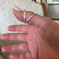 CMC/MCP Thumbsplintring© Stable Thumb Splint Ring Thumb Splint Ring ...