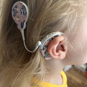 Cochlear N8 Skin Digital File - Etsy