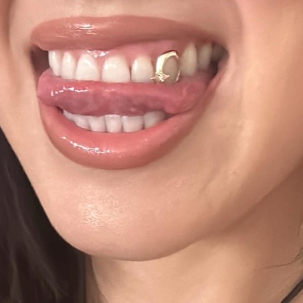 Classic Heart Window Tooth Cap! Custom Grillz, FREE Shipping! - Etsy