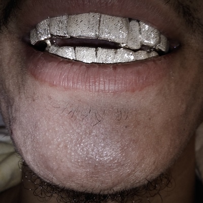 Silver Grillz 925 Sterling Silver Teeth Real Diamond Dust Silver Grill ...