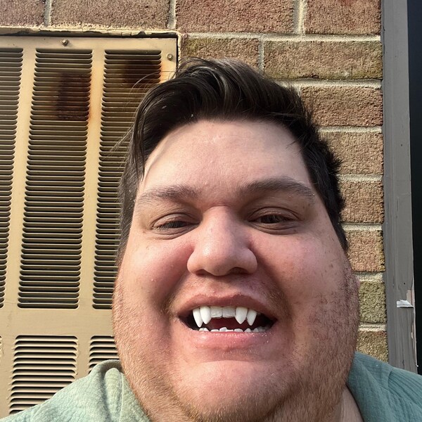 Get a Great Fiting Custom Retainer With Added Diamonds. You Choose Your ...