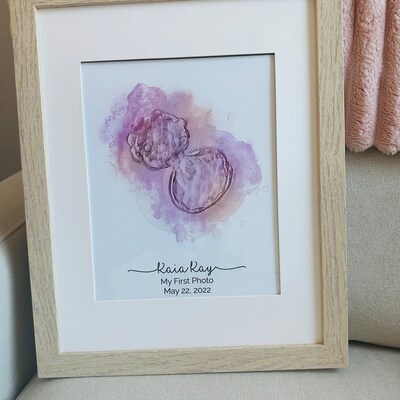 Custom IVF Art Embryo Watercolor Personalized Pregnancy Gift Nursery ...