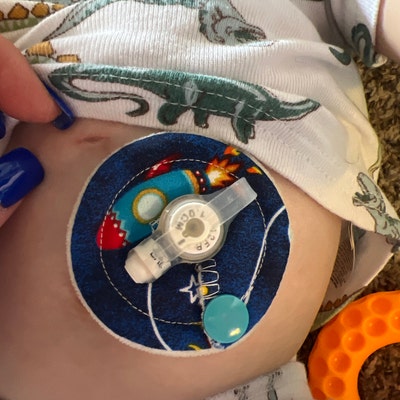 5 G-tube Pads G-tube Covers Gtube Pads Buttons Feeding Tube - Etsy