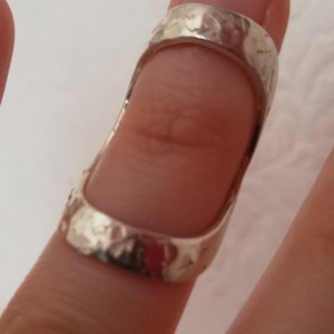 Textured 935 Single Ring Splint for Stabilising Fingers and Thumbs. EDS ...