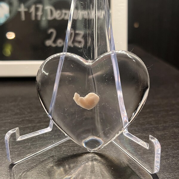 Memory Miscarriage, 5th Week of Pregnancy, Star Child, Heart Embryo, 5 ...