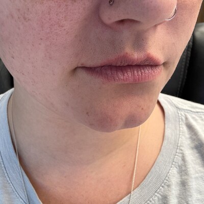 1.5mm Super TINY DISC Threadless Stainless Steel Piercing Tragus ...