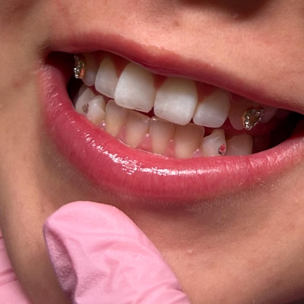 Tooth Gem Training, Tooth Gem Certification, Tooth Gem, E-course, Tooth ...