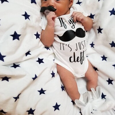 If You Mustache It's Just a Cleft, Cleft Lip and Palate Onesie®, Cleft ...