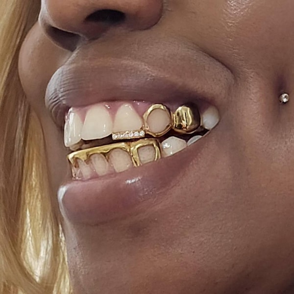 Custom 10 Piece Grillz Set With Trillion Tips and Open Windows in Two ...