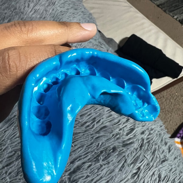 The BEST Mold Kits for Grillz Mold Impression Kit for Custom Grillz ...