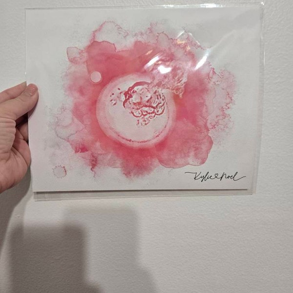 Custom Watercolor Ultrasound Art, Father's Day Gift, Heart Sonogram ...