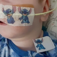 Ng Tube, Nasogastric or Oxygen Tube Adhesive Tape Length Floral MIX ...