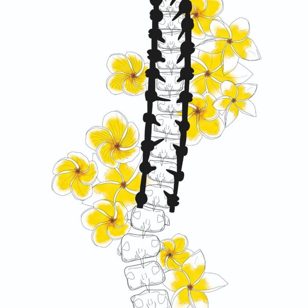 Custom Scoliosis / Spinal Fusion Digital Art Print PRINTABLE File ...