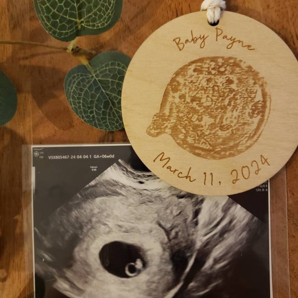 IVF Announcement Sign Our IVF Miracle Keepsake Infertility Journey Made ...