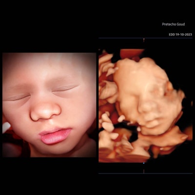 8K Ultrasound Turn 3D/5D/HD Ultrasounds Into an 8K Image - Etsy