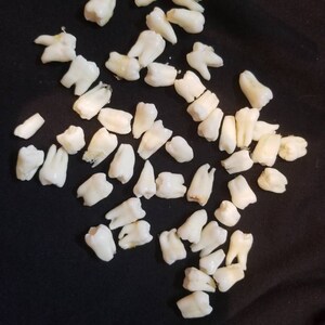 One Real Human Tooth Pendant Necklace - Etsy