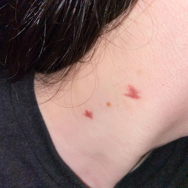 Astarion | Temporary Tattoos | Realistic | Vampire Bite Mark Tattoo | Cosplay | Costume | Scar ...