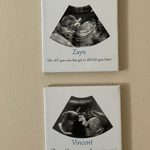 Sonogram Print, Nursery Wall Art, A Personalized Ultrasound Canvas ...