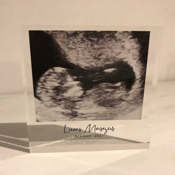 Baby Scan Photo Print, Baby Scan Keepsake, Baby Shower Gift, Baby Scan ...