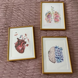 Ovary Art Female Anatomy Ovaries Art Ovarian Cancer Gift Uterus Print ...