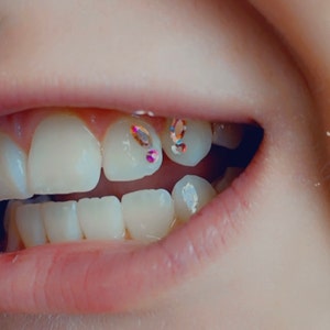 Gold 18K Tooth Gem - Etsy