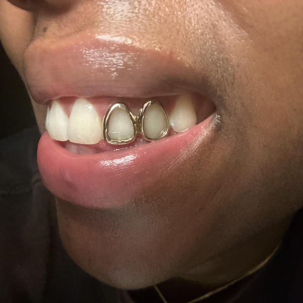 Double Window Tooth Grillz: Custom Gold/silver Caps - Etsy