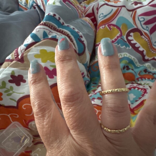 Arthritis Finger Splint for Bcnding Sideways Lateral Deviation Sterling ...