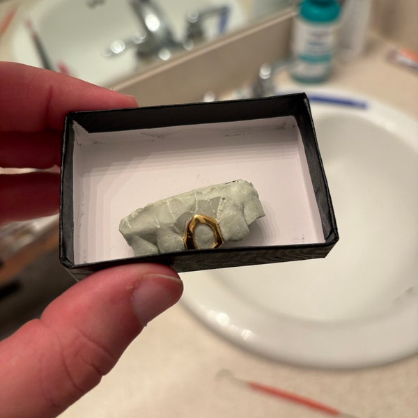 Custom Solid Gold Grillz / Permanent Cut / Deep Cut Custom Gold Grillz ...