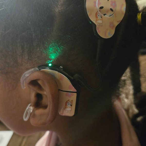 Cochlear Implant Skins Cochlear Implant Stickers - Etsy