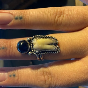 Your Own Custom Tooth Ring - Etsy