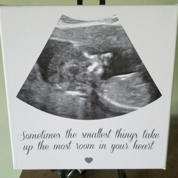 Sonogram Print, Nursery Wall Art, A Personalized Ultrasound Canvas ...