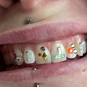 Tooth Gems Butterfly - Etsy