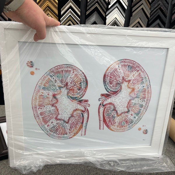 The Kidneys Anatomy Watercolor Print Human Kidneys Poster Urology Art ...