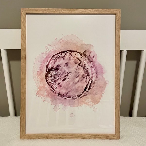 Custom IVF Art Embryo Watercolor Personalized Pregnancy Gift - Nursery ...