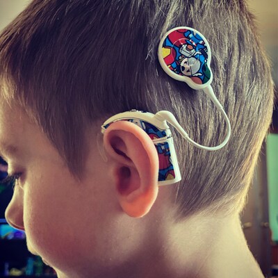 Construction Vinyl Cochlear N6 and N7 Skins - Etsy