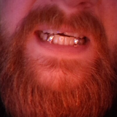 Real Solid 10K Gold Grillz Double Canine Incisor Iced Inlay - Etsy