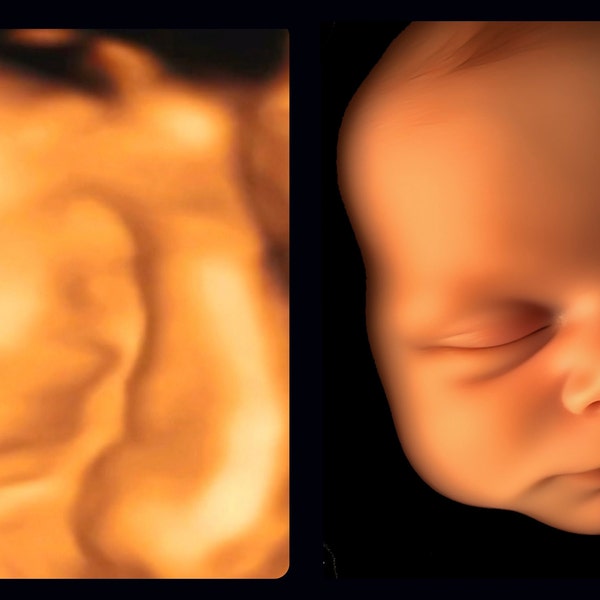 Ultrasaund 8k Baby Image 3d 4d 5d 8d Real View Baby AI Photo ...