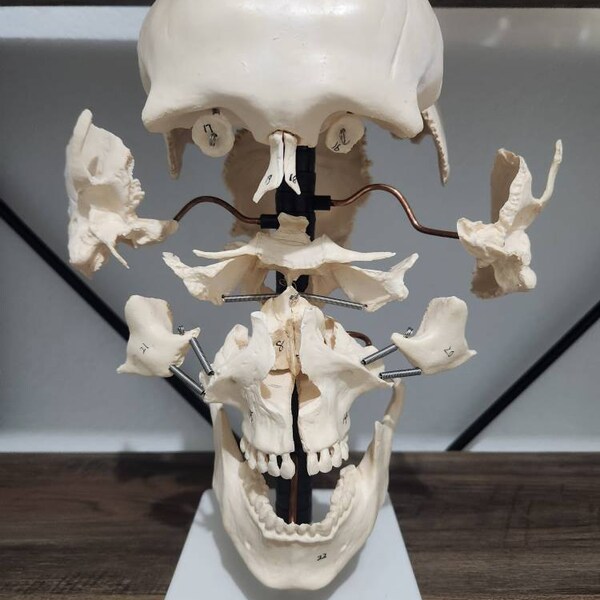 Exploded Human Skull - Beauchene Skull Model - Medical Display Model for Education or as Oddity ...