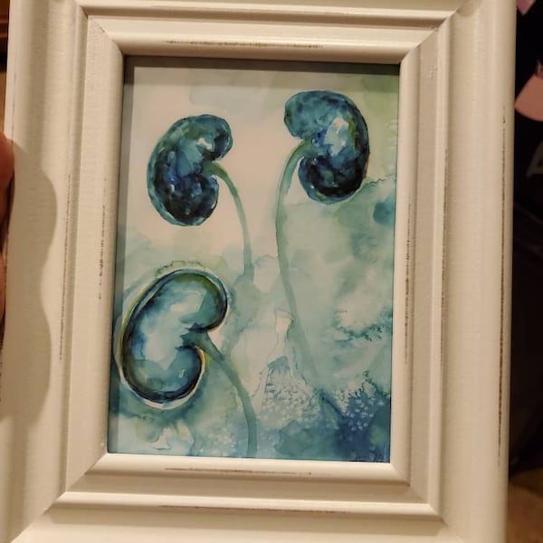Transplant Kidney Watercolor Print - Anatomical Kidney Art - Nephrology ...
