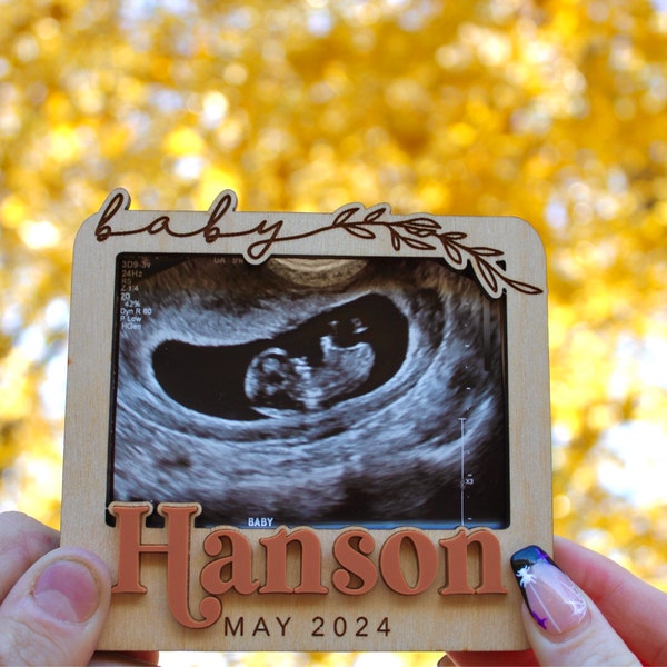 Magnetic Photo Frame | Ultrasound Magnetic Frame | Baby Announcement ...