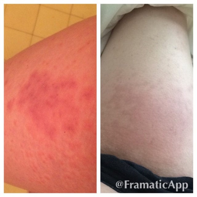 chelsea loved their purchase from PupppRelief