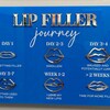 Lip Filler Injections Journey Acrylic A3 Wall Sign | Beauty Sign ...