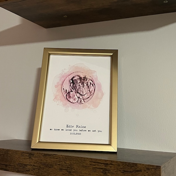 Custom IVF Art Embryo Watercolor Personalized Pregnancy Gift - Nursery ...