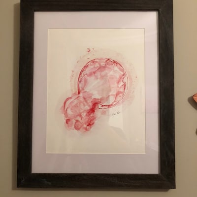Custom Embryo Watercolor Commission an Original Painting of Your Embryo ...
