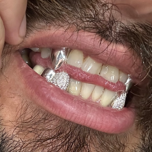 Custom Grillz With Extended K9s and Back Bar - Etsy