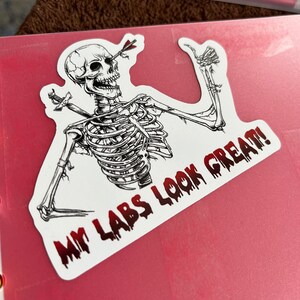 Ehlers Danlos Awareness Ribbon EDS Sticker Rare Disease Awareness - Etsy