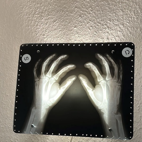 X-ray Led Lighted Picture With Spine, Brighted Radiography Picture ...